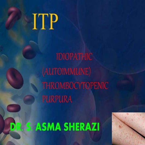 "ITP" | PPT