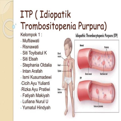 ITP ( Idiopatik Trombositopenia Purpura)(1).pptx