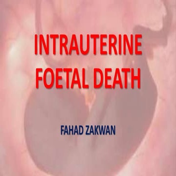 Intrauterine fetal death | PPTX