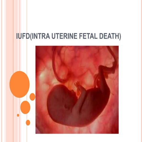 IUFD(INTRA UTERINE FETAL DEATH).pptx