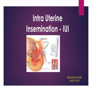 Intrauterine Insemintion IUI powerpoint presentation | PPTX