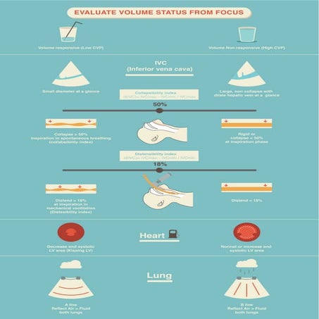 Ivc summary infographic | PDF