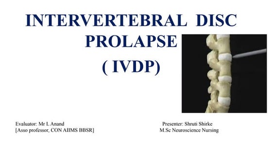 Intervertebral disc prolapse(ivdp) | PPTX | Bone and Joint Conditions ...
