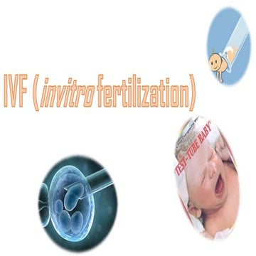 Ivf | PPTX