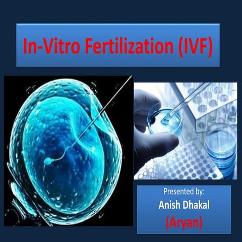 In vitro Fertilization for Undergraduate Medical Students | PPTX