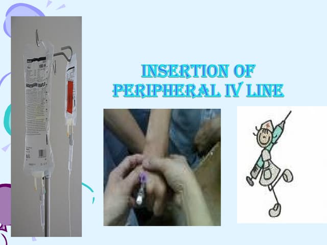 Pediatric intravenous cannulation | PPTX