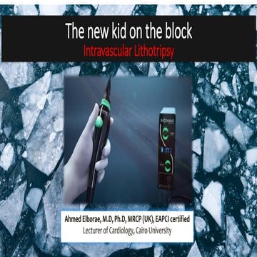 Coronary shock wave lithotripsy balloon (IVL) | PDF