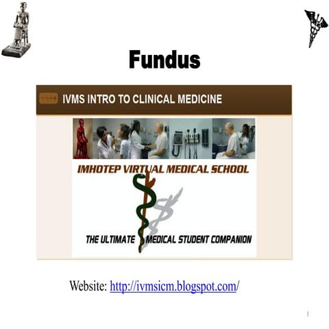 IVMS -ICM - Fundus | PDF | Eye and Vision Conditions | Diseases and ...