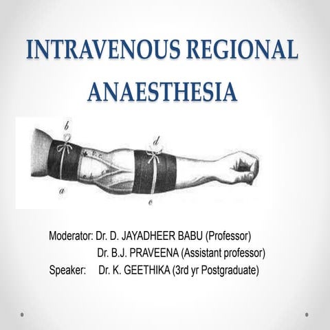 Presentation on intravenous regional anaesthesia | PPTX