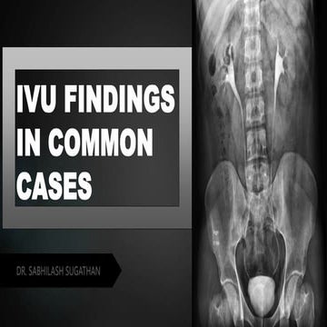 IVU FINDINGS.pptx