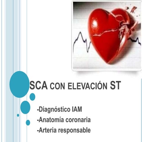 Sca anatomia coronaria 2015 | PPTX
