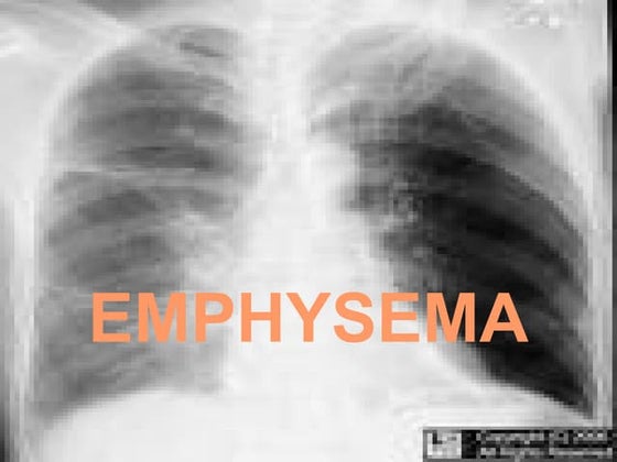 Emphysema | PPTX