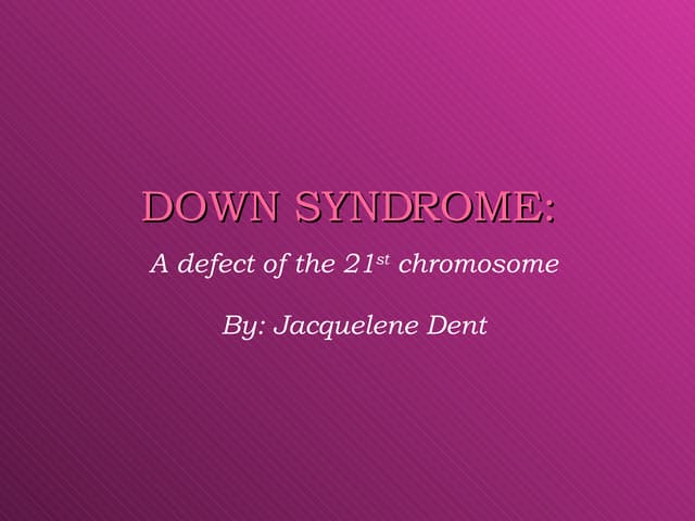 Science infographic on down syndrome - pargert