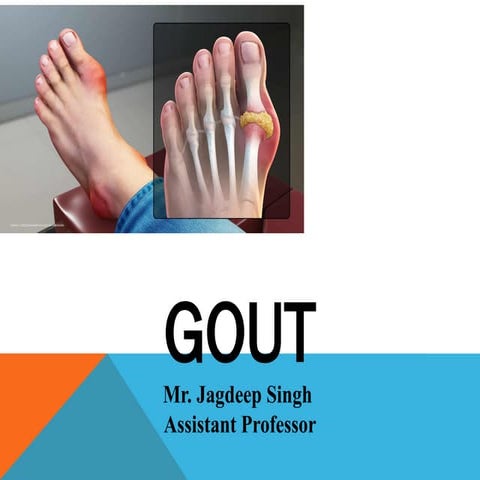 Pathophysiology of Gout: Unraveling the Mechanisms Behind the Crystal ...