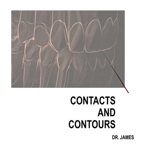 CONTACTS AND CONTOURS IN DENTISTRY | PPTX