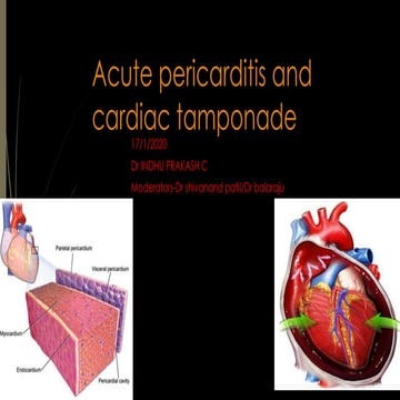 acute pericarditis | PPTX