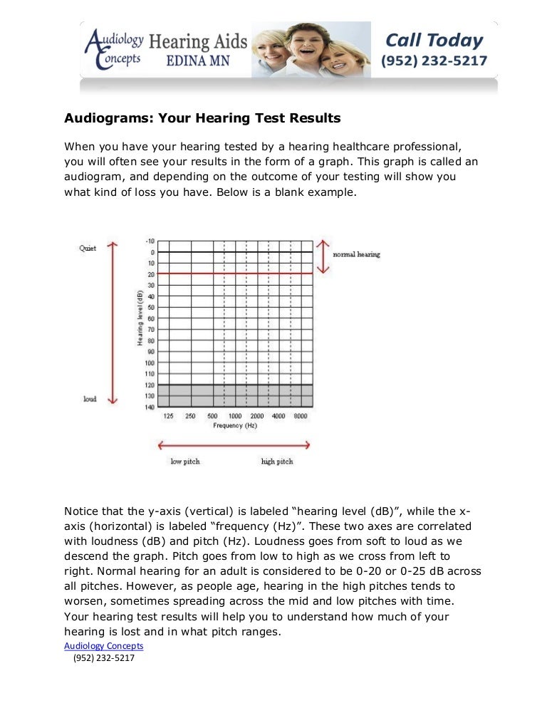 Audiograms: Your Hearing Test Results