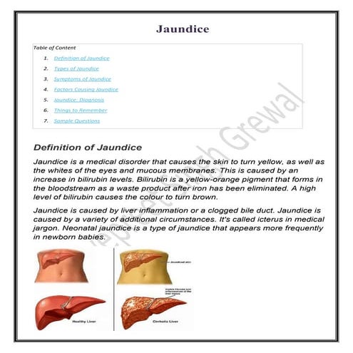 Jaundice.docx