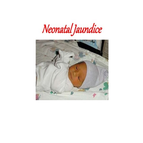 Neonatal jaundice presentation | PPTX