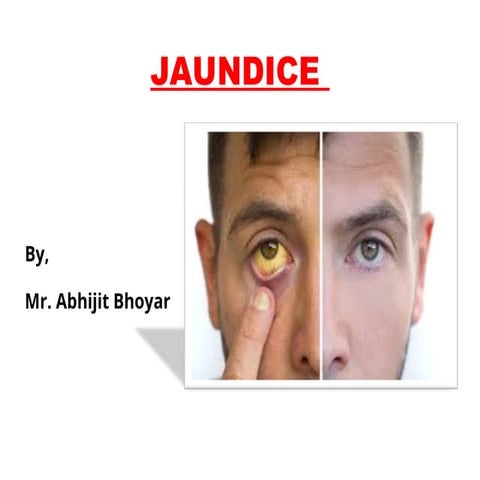 JAUNDICE-.ppt_Biochemistry for nursing students | PPT