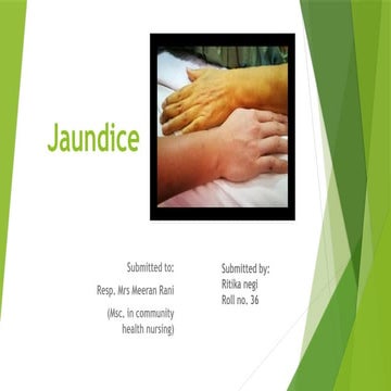 jaundice c.pptx in community health nursing | PPTX