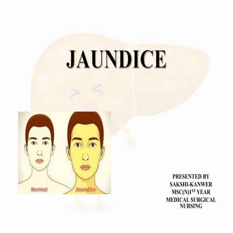 jaundice-(three types)- pre hepatic, hepatic , post hepatic | PDF
