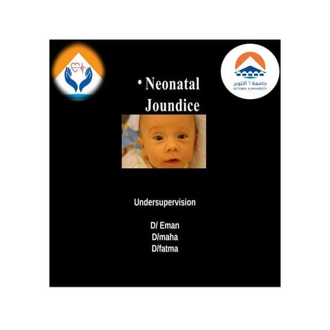 jaundice ppt finnal (1).pptxjfjfjfjfjfj | PPTX