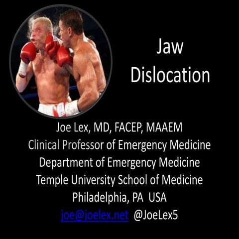 Jaw dislocation | PPTX