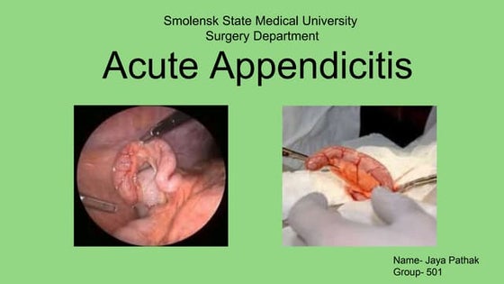 Endoscopic treatment of bile duct. | PPT