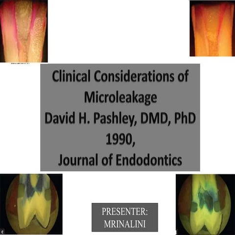 David H Pashley: Clinical considerations of microleakage | PPTX