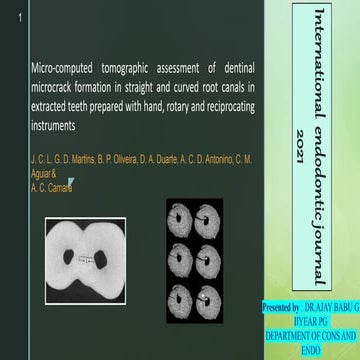 Micro-computed tomographic assessment of dentinal microcrack formation ...