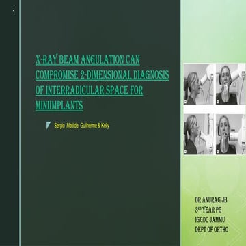 X-ray beam angulation can compromise 2-dimensional diagnosis of ...