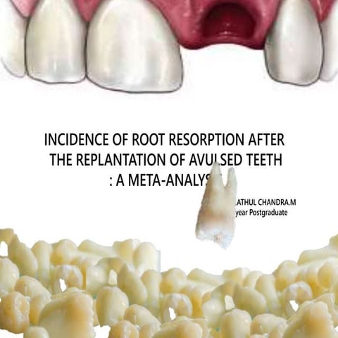 Forces acting on restoration | PPTX