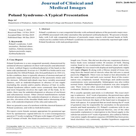 Poland Syndrome-A Typical Presentation | PDF