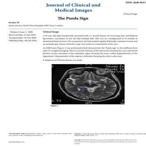 The Panda Sign | PDF