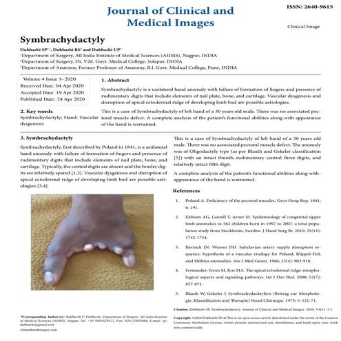 Symbrachydactyly | PDF