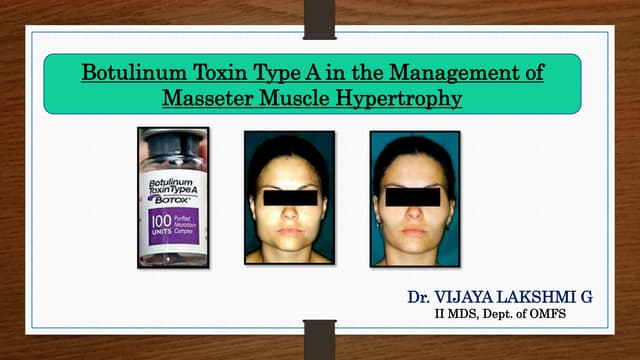Jc On Intramuscular Injection Of Botox For Massetric Hypertrophy Ppt
