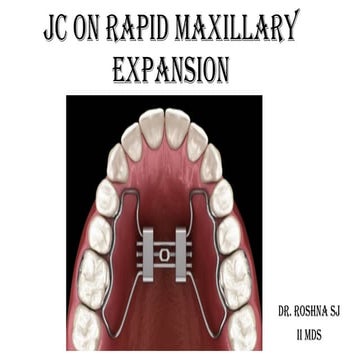 EXPANSION APPLIANCES IN ORTHODONTICS.pptx