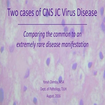 Pathology of JC Virus | PPTX