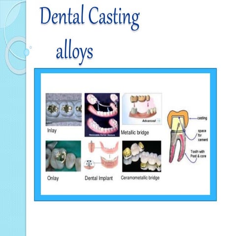 Dental Casting Alloys | PPTX