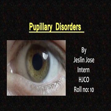 PUPIL AND ITS DISORDERS | PPTX