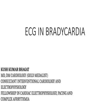 ECG Lecture: Sinus arrest, sinoatrial exit block, AV block and escape ...