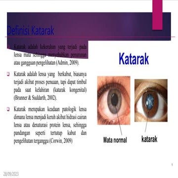 KATARAK.pptx