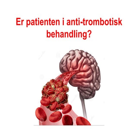 NOAC, DOAC, TEG, ROTEM, ICH, SAH. | PPT