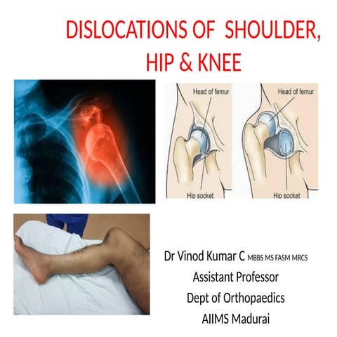 Dislocation of major joints ( Shoulder , hip and knee) | PPTX