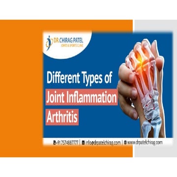 Joint Inflammation Arthritis Types and Treatment.pptx