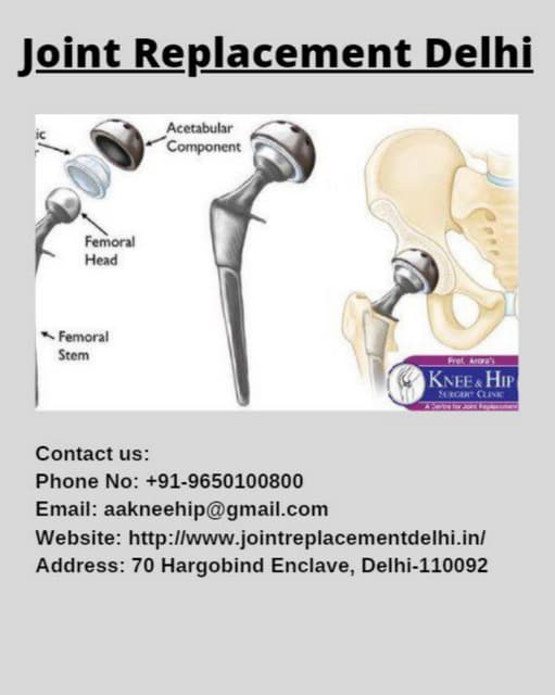 Knee Replacement Surgeon India | PDF