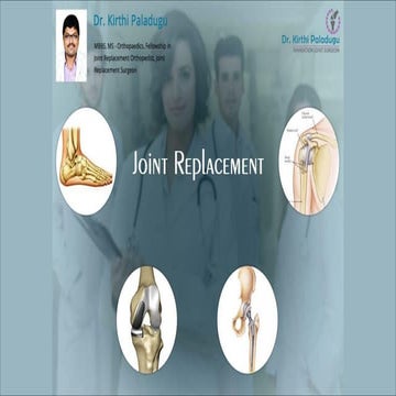 Joint replacement surgery | PDF