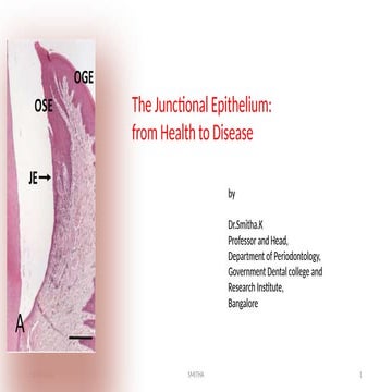 JUNCTIONAL EPITHELIUM in health and disease | PPTX