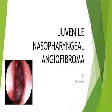 JUVENILE NASOPHARYNGEAL ANGIOFIBROMA.pptx